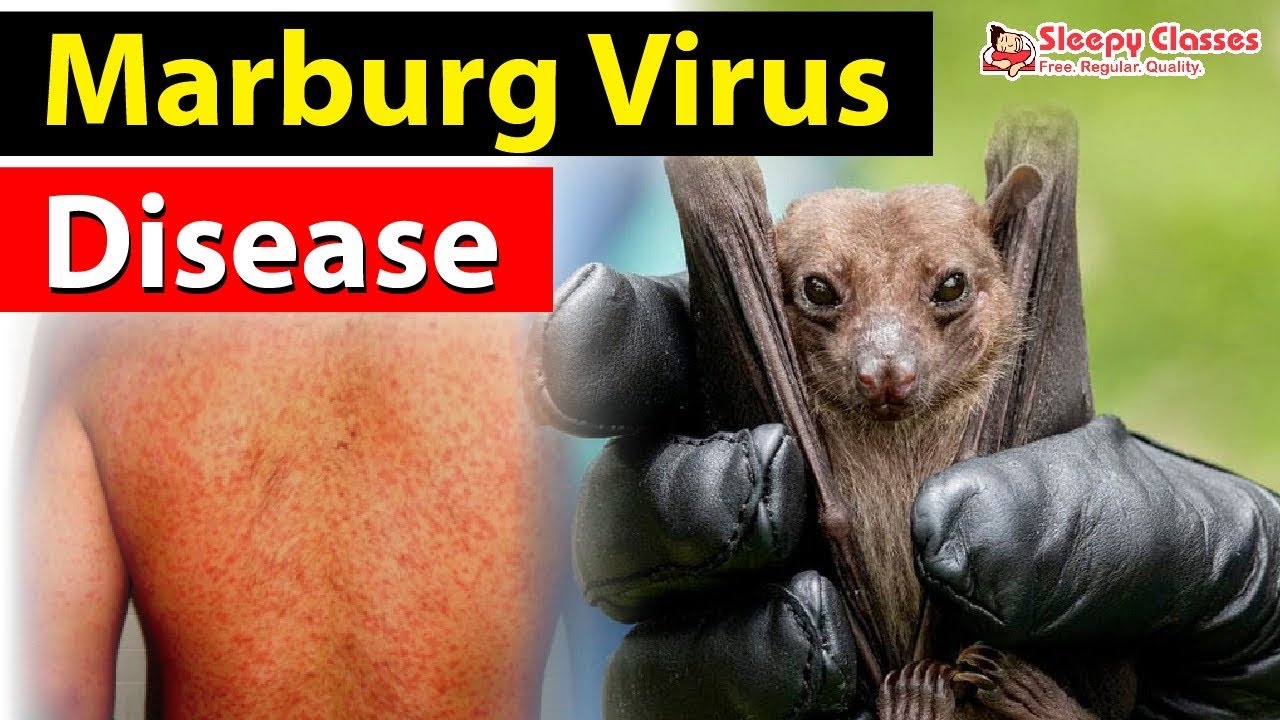 All About Marburg Virus Disease. Explained in less than 5 minutes ...