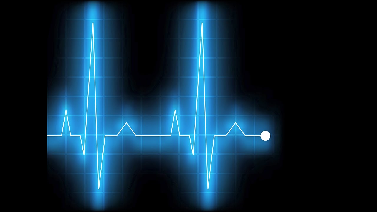 Quick review | Atrial flutter, PSVT | With mnemonics ! - YouTube