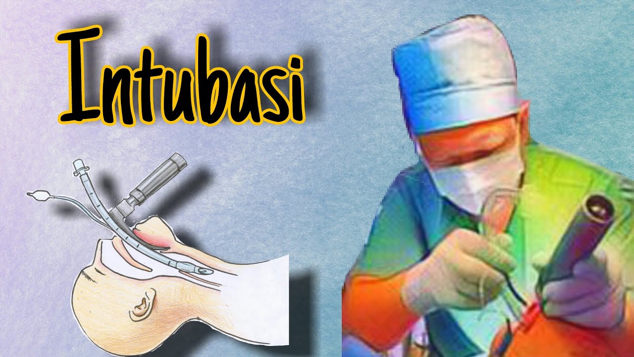 Tehnik Intubasi Part 2 - YouTube