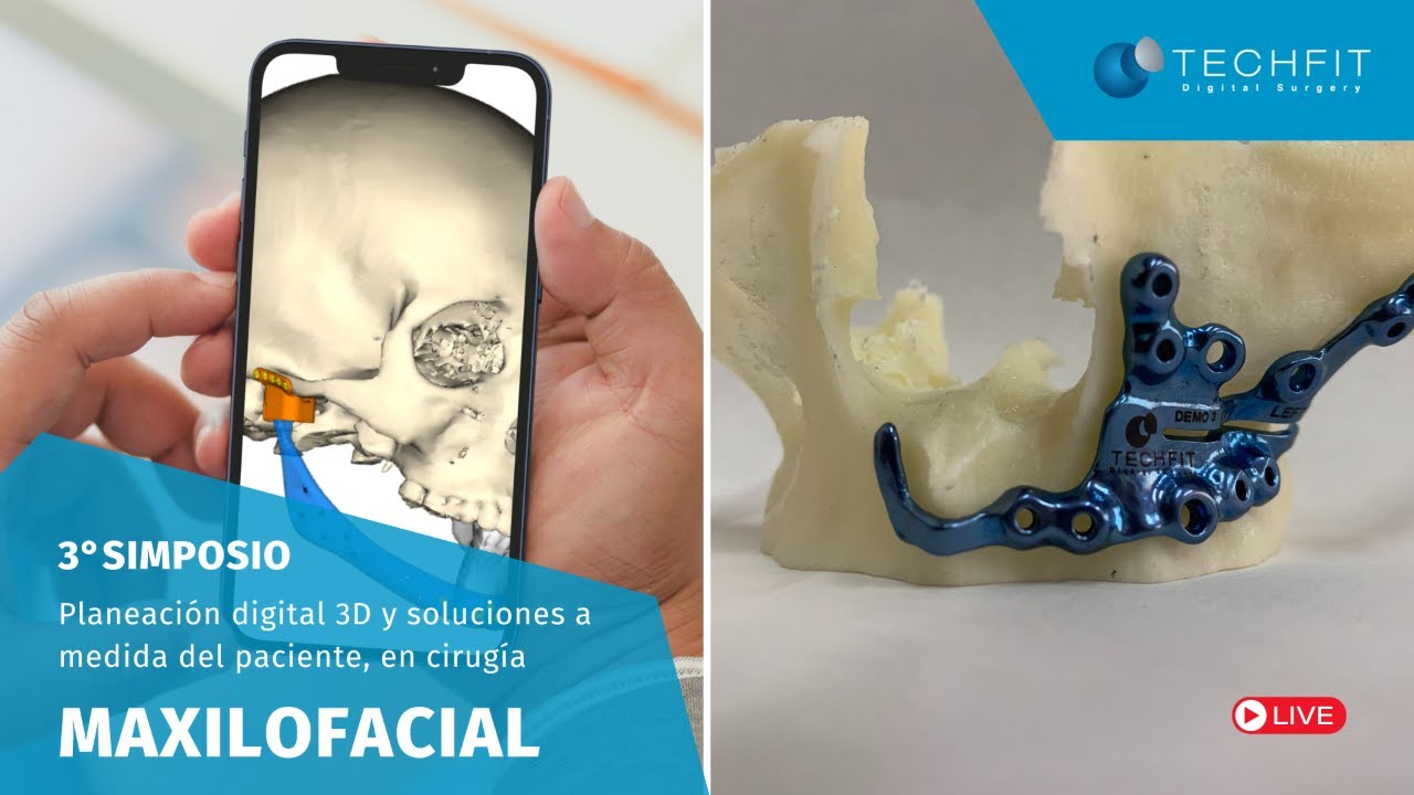 3er Simposio Cirugía Maxilofacial - TECHFIT Digital Surgery - YouTube