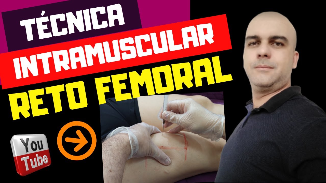 Reto Femoral técnica - YouTube