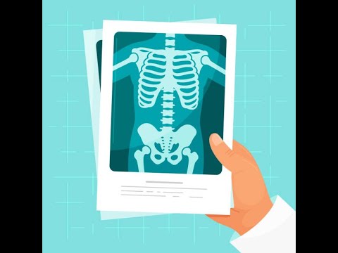 Exposición de rayos X en una mina - BIOLOGÍA CELULAR Y MOLECULAR 🧬 ...