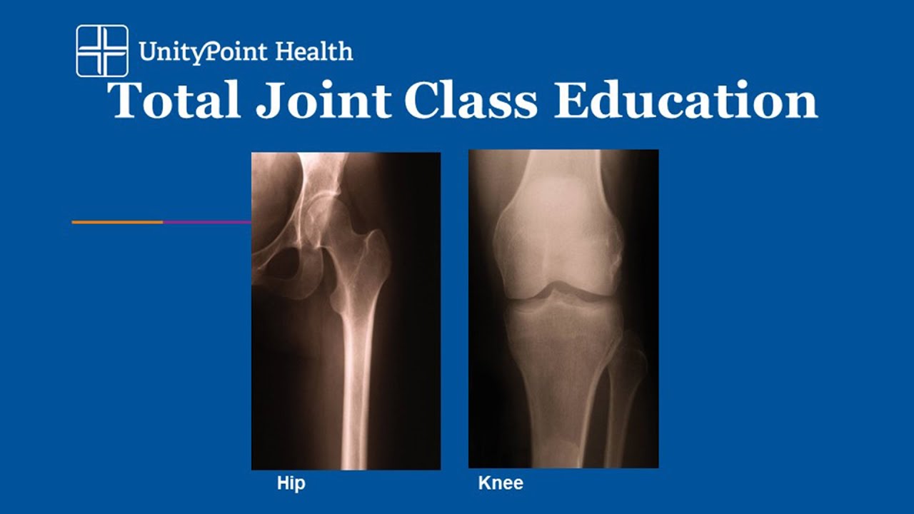 Total Joint Replacement Education - Iowa Lutheran Hospital - YouTube