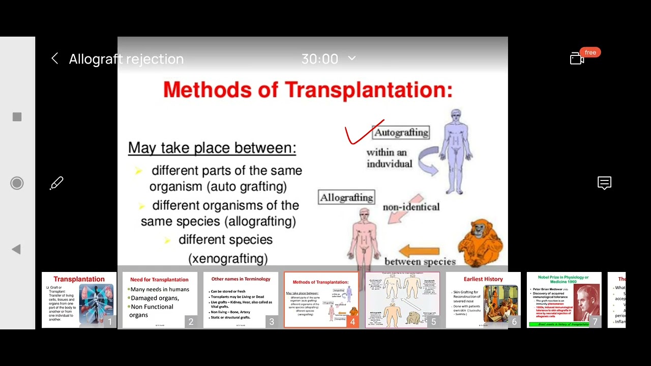Transplantation Reaction/Types of Graft / Transplantation Antigens ...