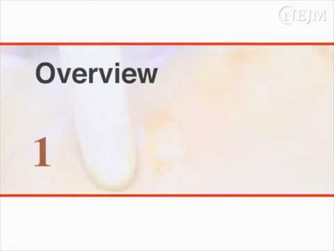 Suprapubic bladder aspiration - YouTube