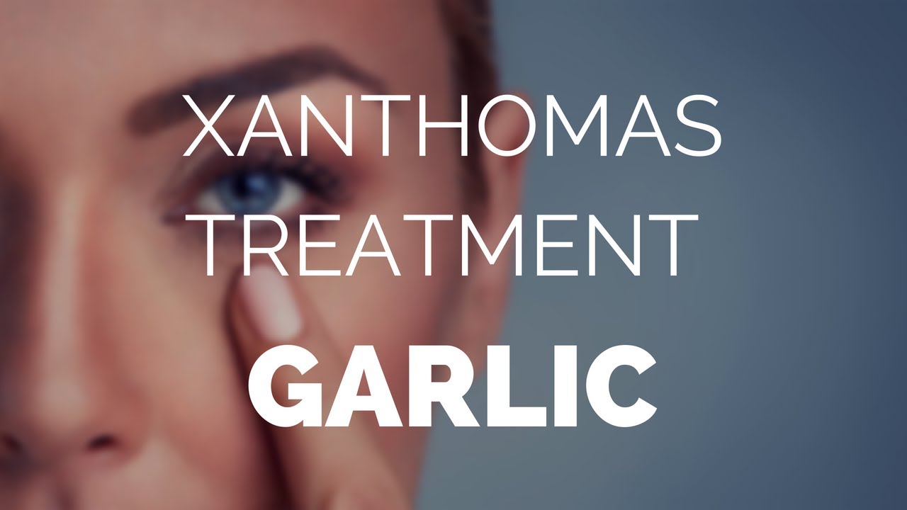 Xanthomas Causes And Treatment Options Skin Site