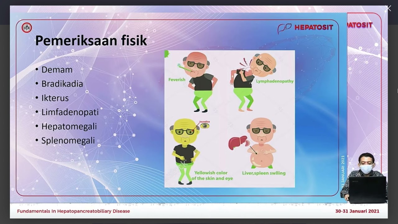 Hepatosit - Hepatitis A Klinis, Diagnosis dan Tatalaksana - YouTube