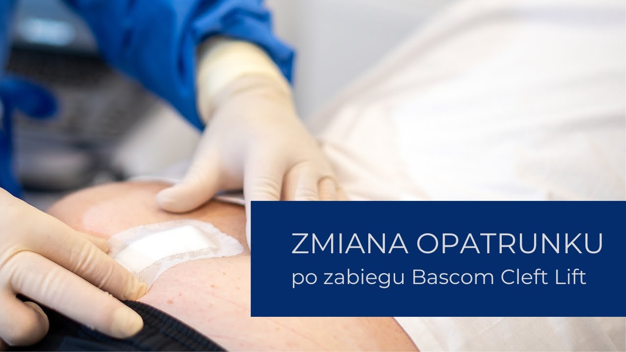 Zmiana opatrunku po zabiegu Bascom Cleft Lift - YouTube