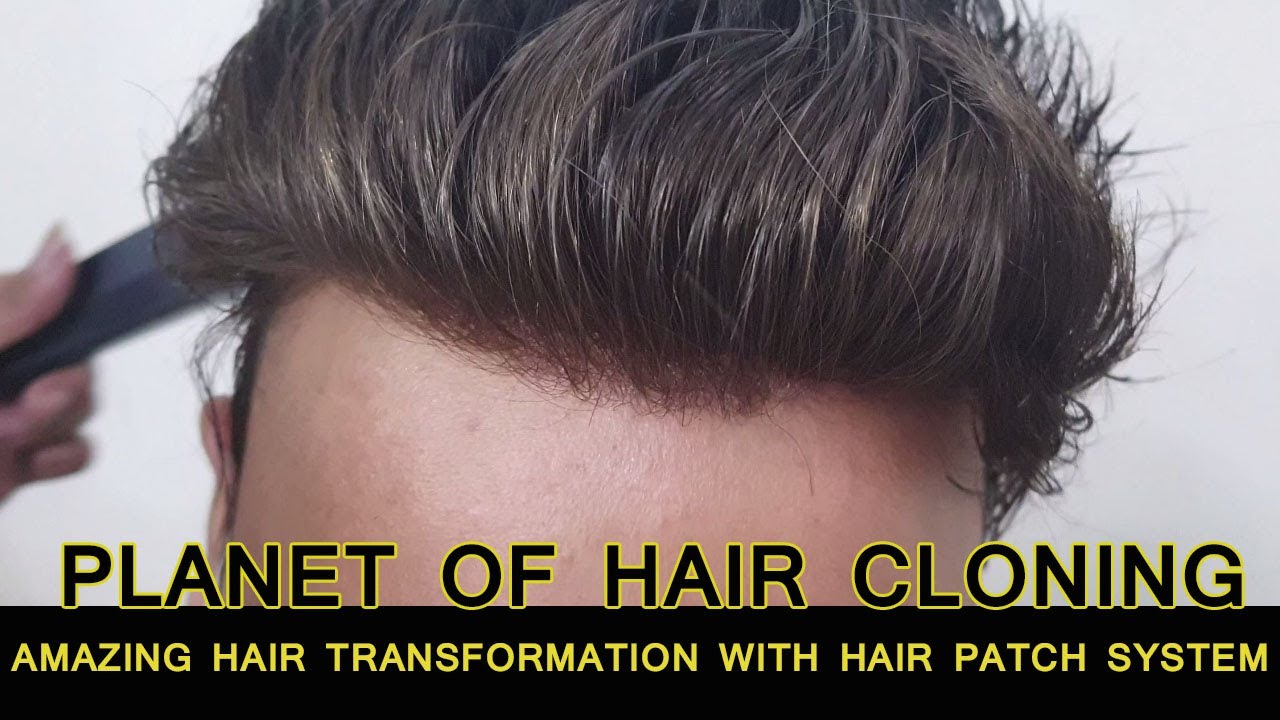 Best Hair Transformation | Hair Patches for Men Thin Hair Extensions ...