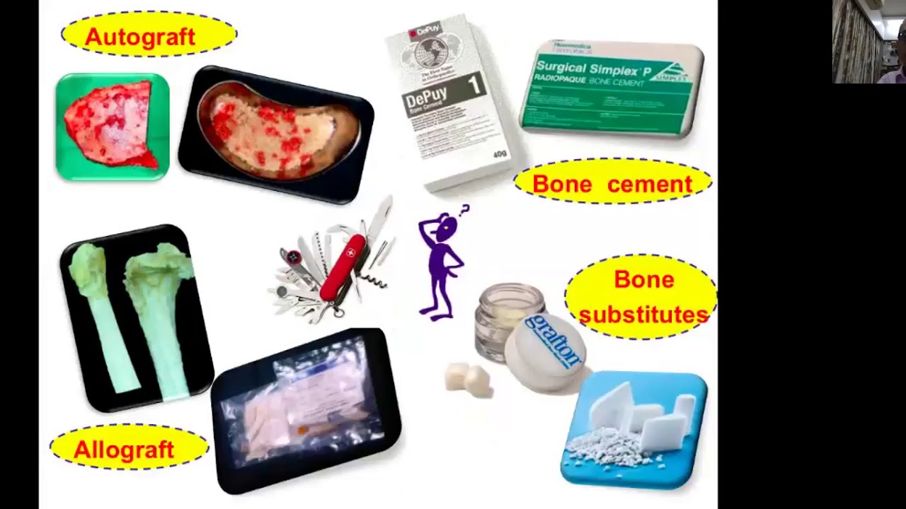 Dr Ajay Puri : Winning Decisions in Benign Bone Tumors - YouTube