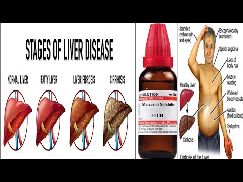Merc Sol In Hepatic Disorder | Liver Disease | mercurius solubilis 30 ...