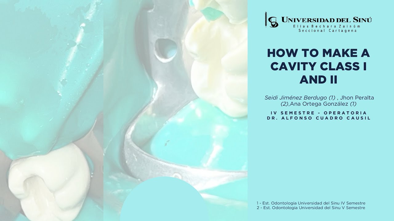 HOW TO MAKE A CAVITY CLASS I AND II - BLACK - YouTube