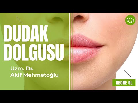 Dudak Dolgusu (Öncesi Sonrası)  I Uzm. Dr. Akif Mehmetoğlu