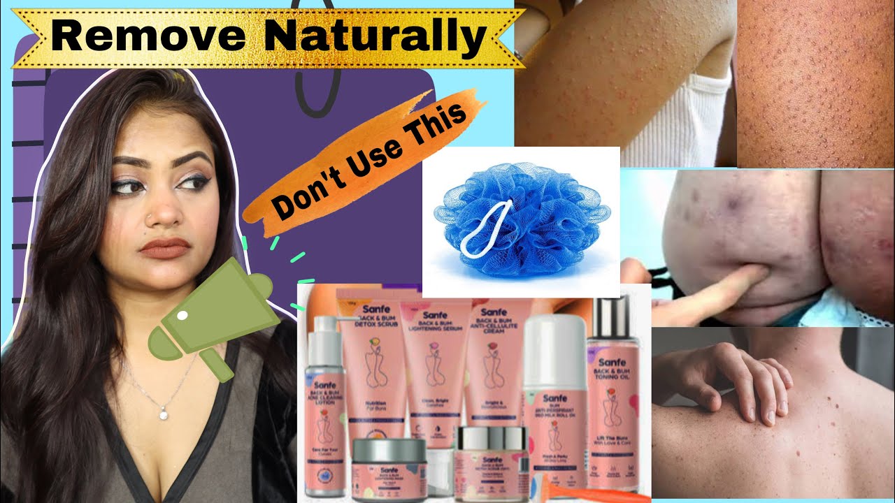 How to remove body bumps|body acne|dull skin treatment|cutomized ...