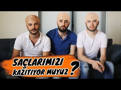 kafalar saclarını kazıtıyormu sorusuna yarın ki videoda belli olcak