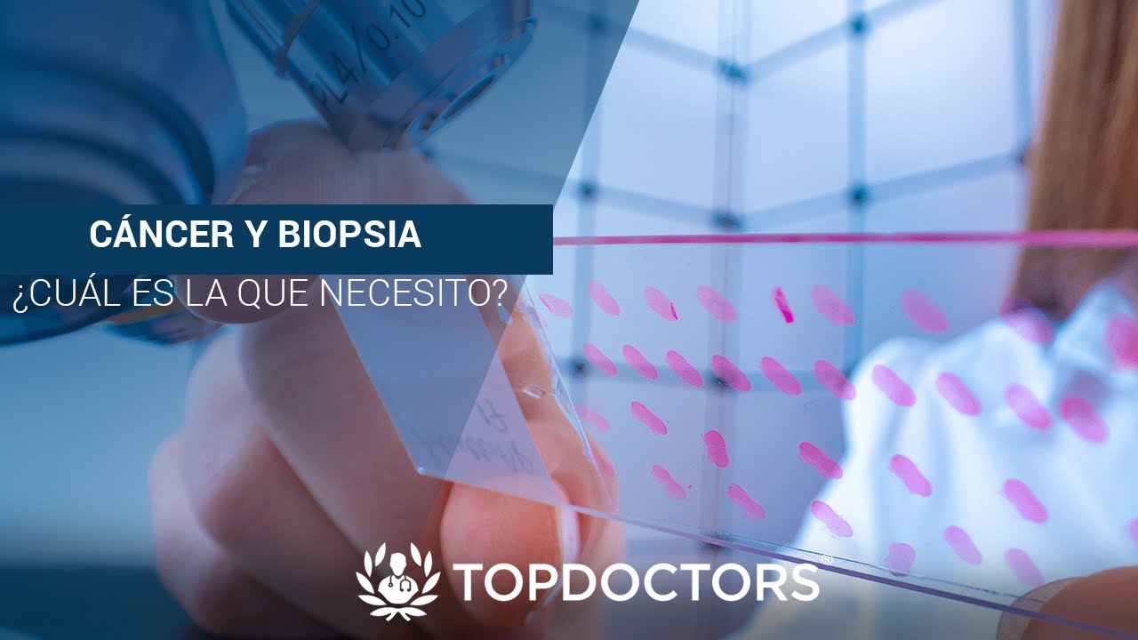 Cáncer y Biopsia ¿Cuál es la que necesito? - YouTube