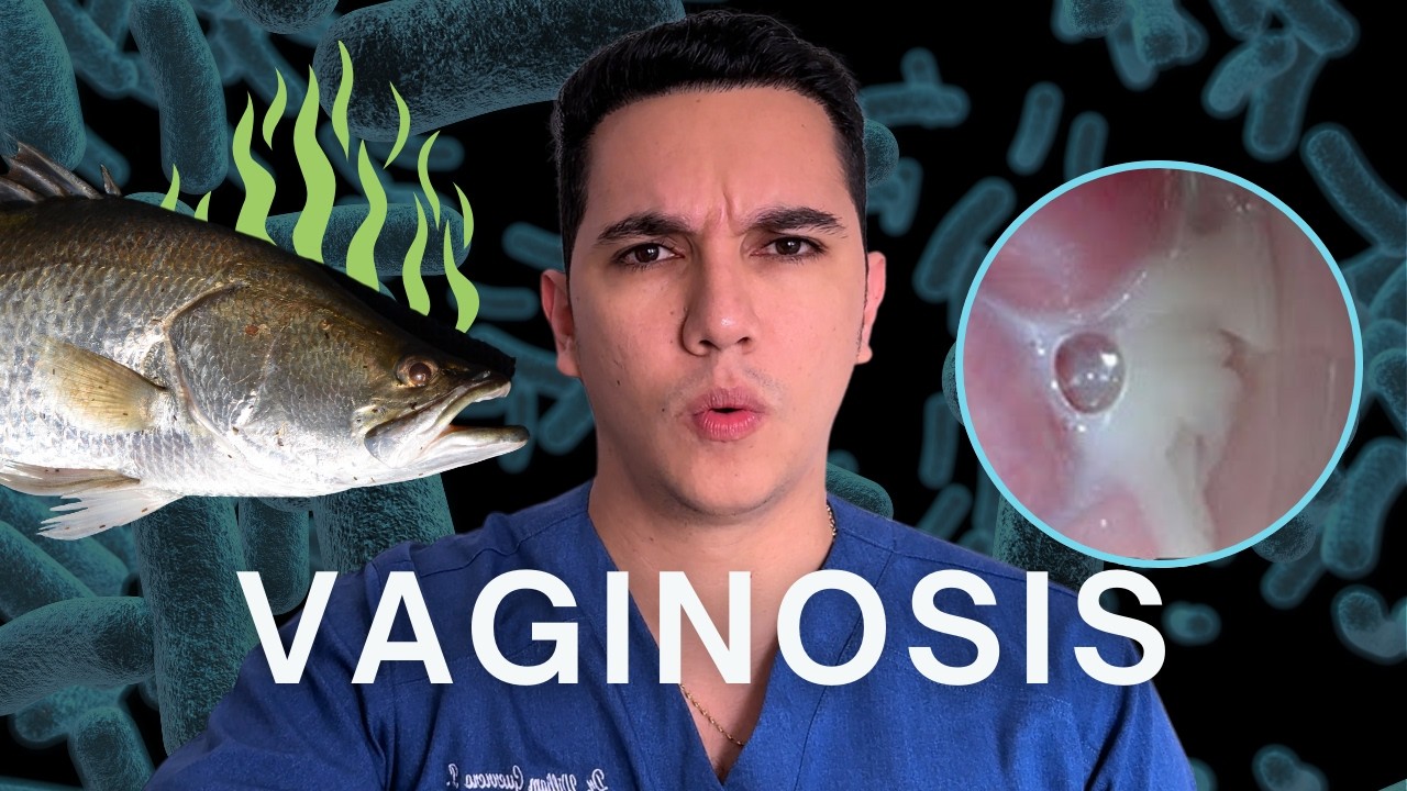 ¿Flujo vaginal de olor a pescado? Puedes tener vaginosis bacteriana ...
