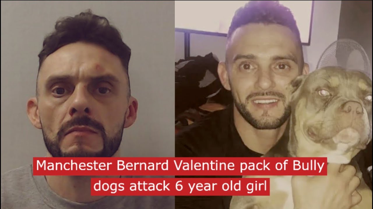 Bernard Valentine pack of Bully dogs attack 6 year old girl #crime # ...