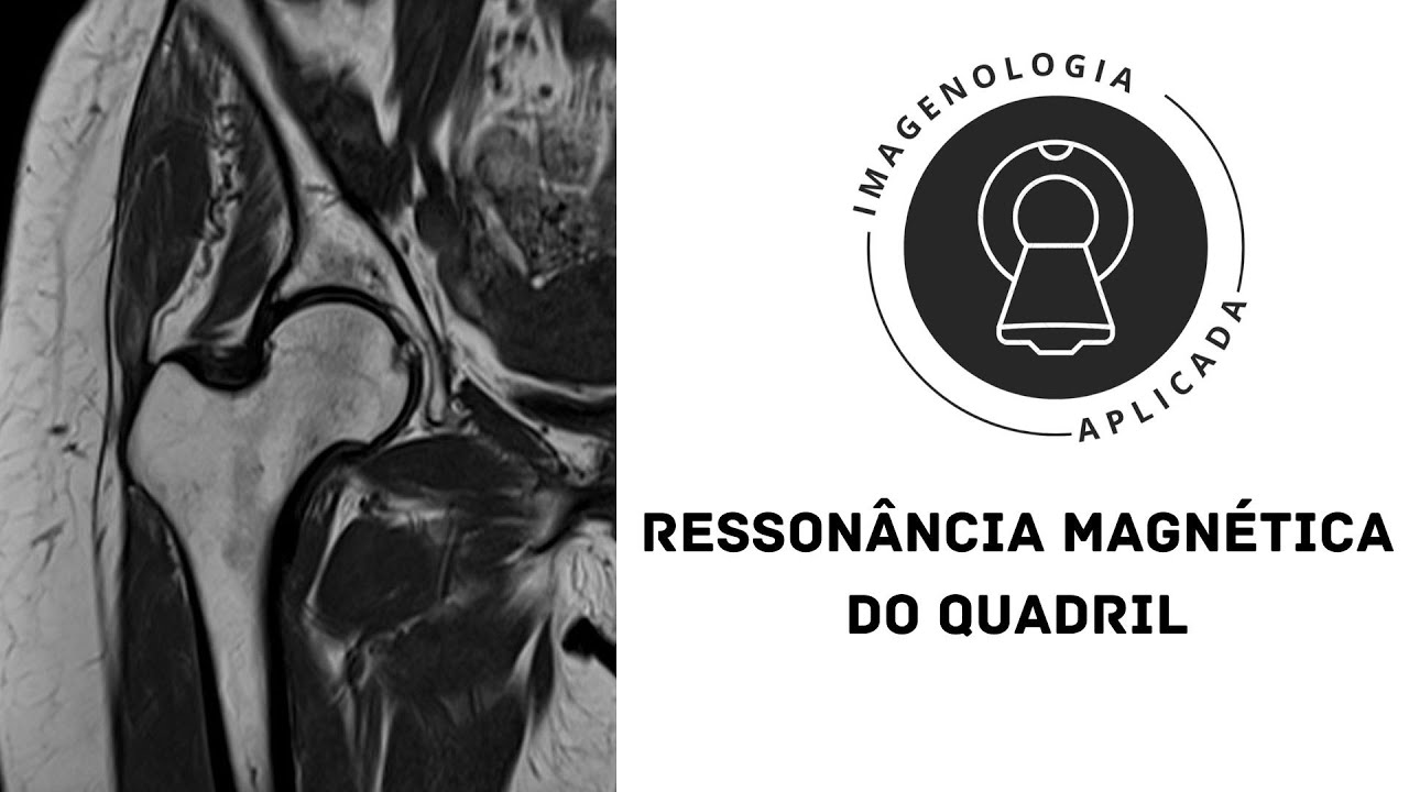 Ressonância Magnética do Quadril. - YouTube