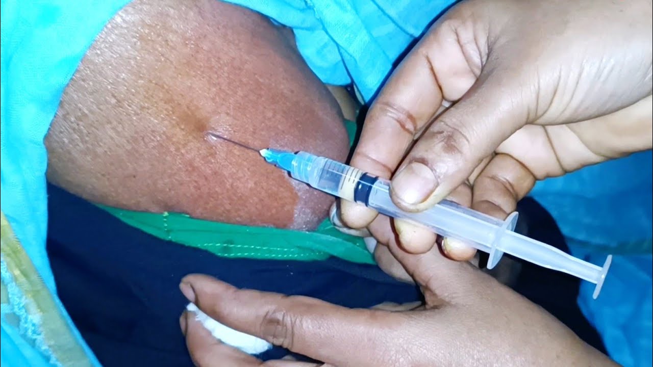 IM Injection Video Dexamethasone injection push 24 Ep 41 By Injection ...