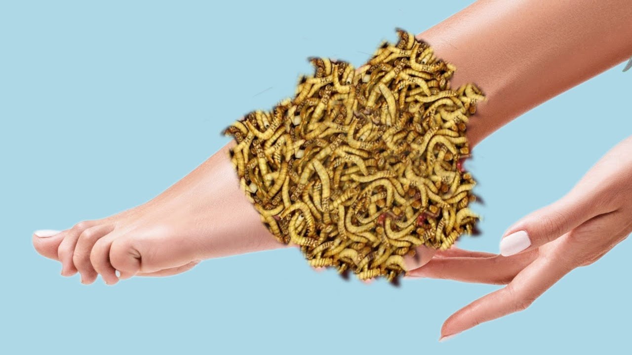 ASMR Treatment animation Remove maggot & tick infected leg | 2D ...