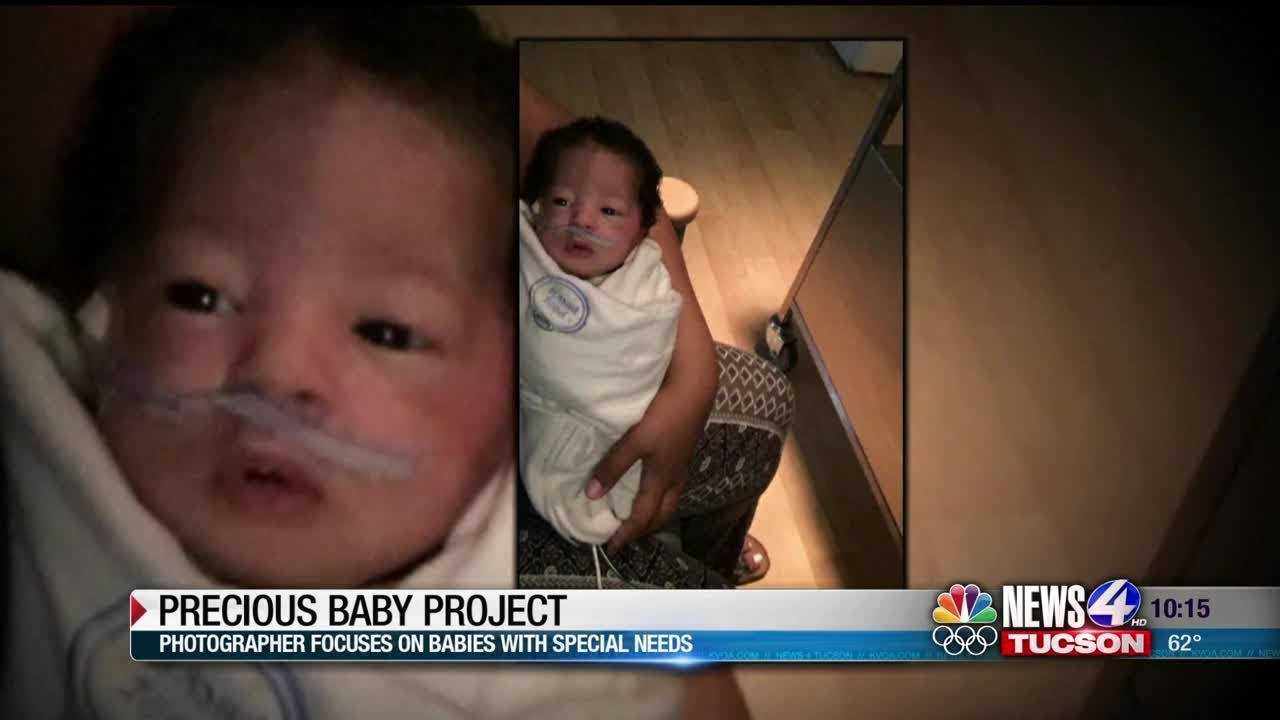 Precious Baby Project photographs infants with special needs - YouTube