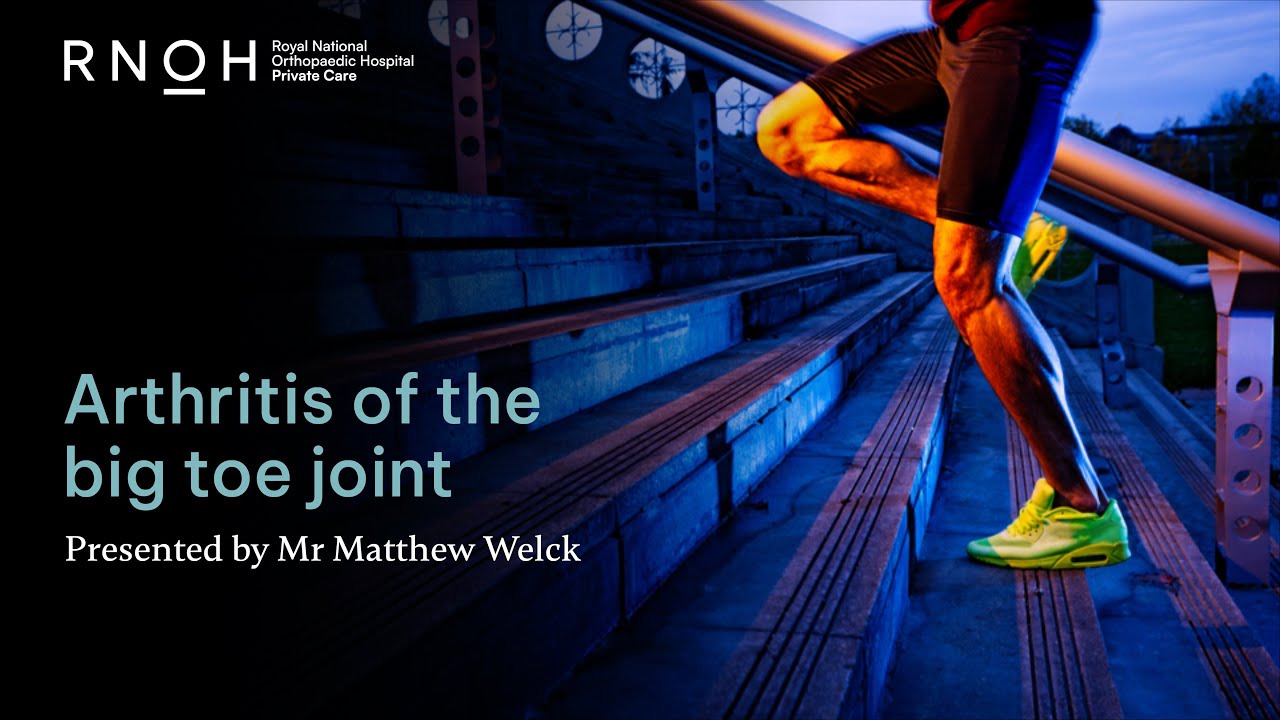 Arthritis of the big toe joint - Mr Matthew Welck - YouTube