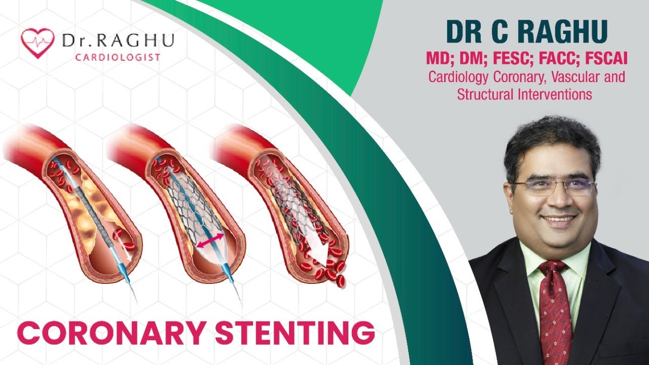 Coronary Stent | Angioplasty and Stent | Dr C Raghu | Cardiologist ...