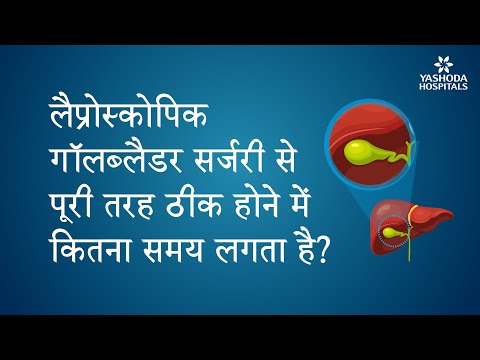 लैप्रोस्कोपिक गॉलब्लैडर सर्जरी से पूरी तरह ठीक होने में कितना समय लगता है?