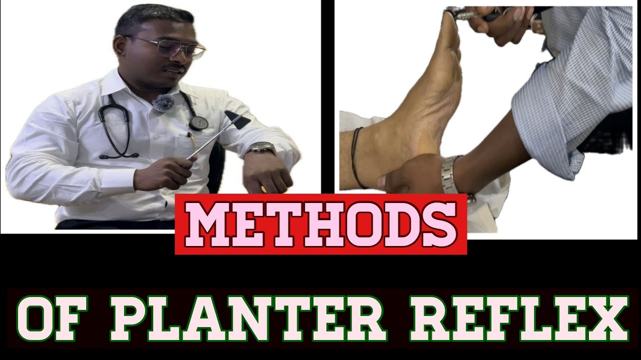 Plantar Reflex Examination | Methods of Testing Babinski Reflex ...