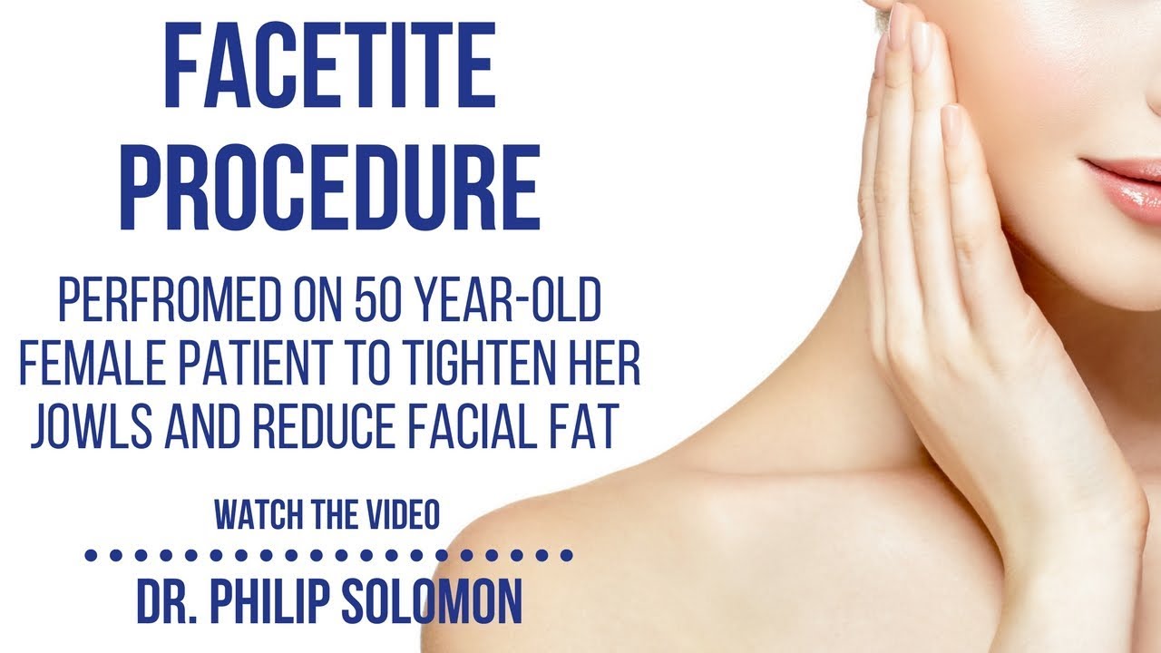 Facetite Procedure | Dr. Philip Solomon - YouTube