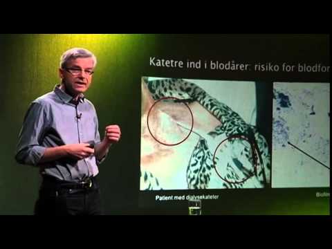 Hospitalsinfektioner - smittekilder og smitteveje - YouTube