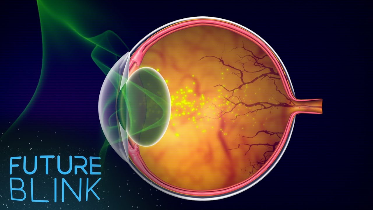 Contact Lenses Zoom in the Blink of an Eye - YouTube