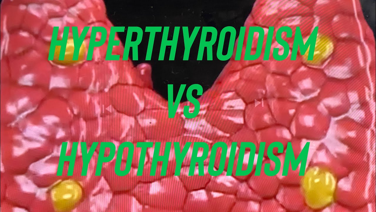 DIFFERENCE ENTRE HYPERTHYROIDISM VS HYPOTHYROIDISM - YouTube