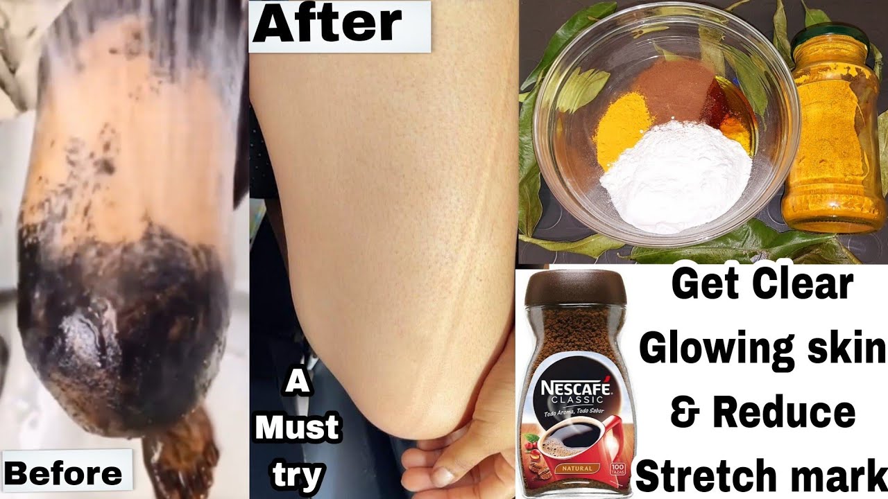 A must try / body scrub for glowing skin stretch mark removal/diy ...