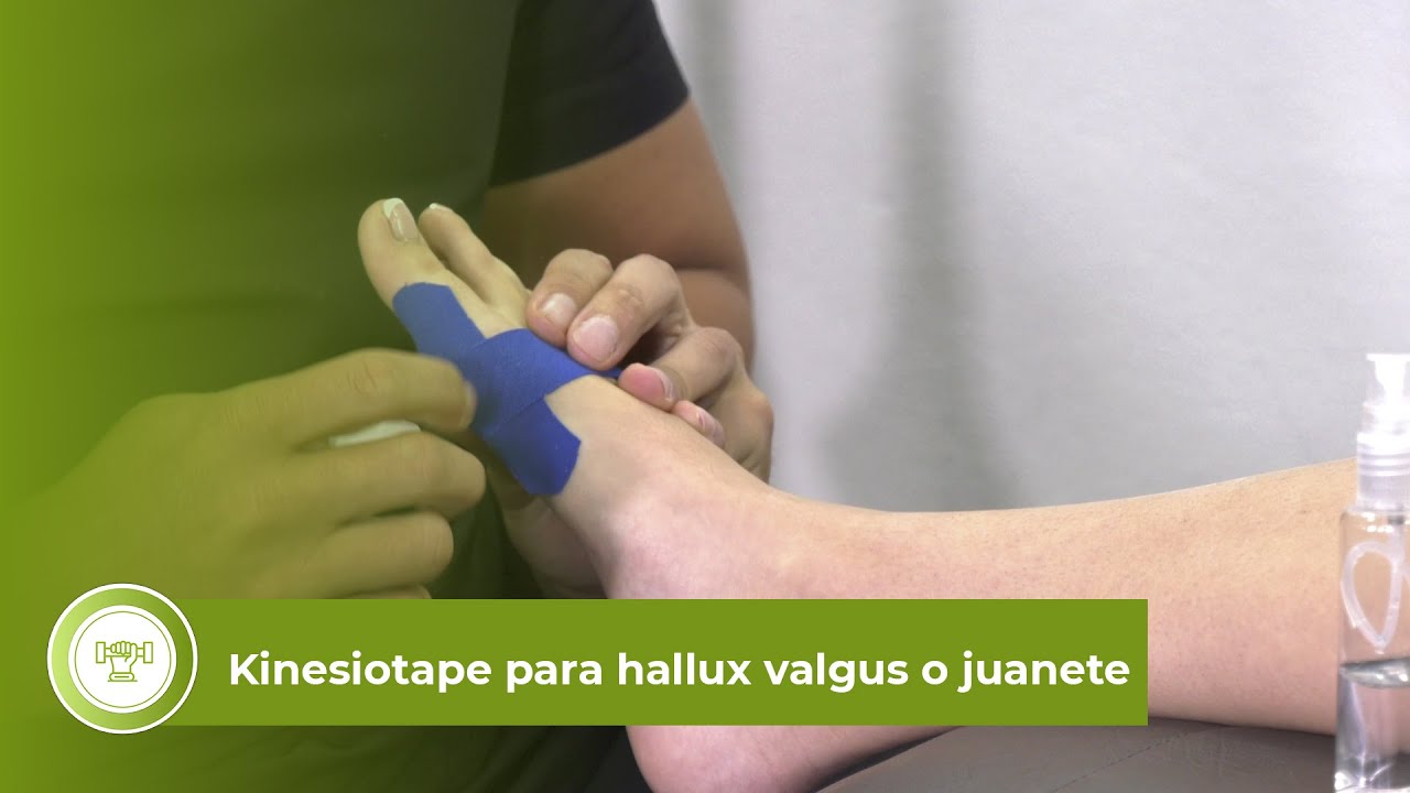 Kinesiotape para hallux valgus o juanete - YouTube