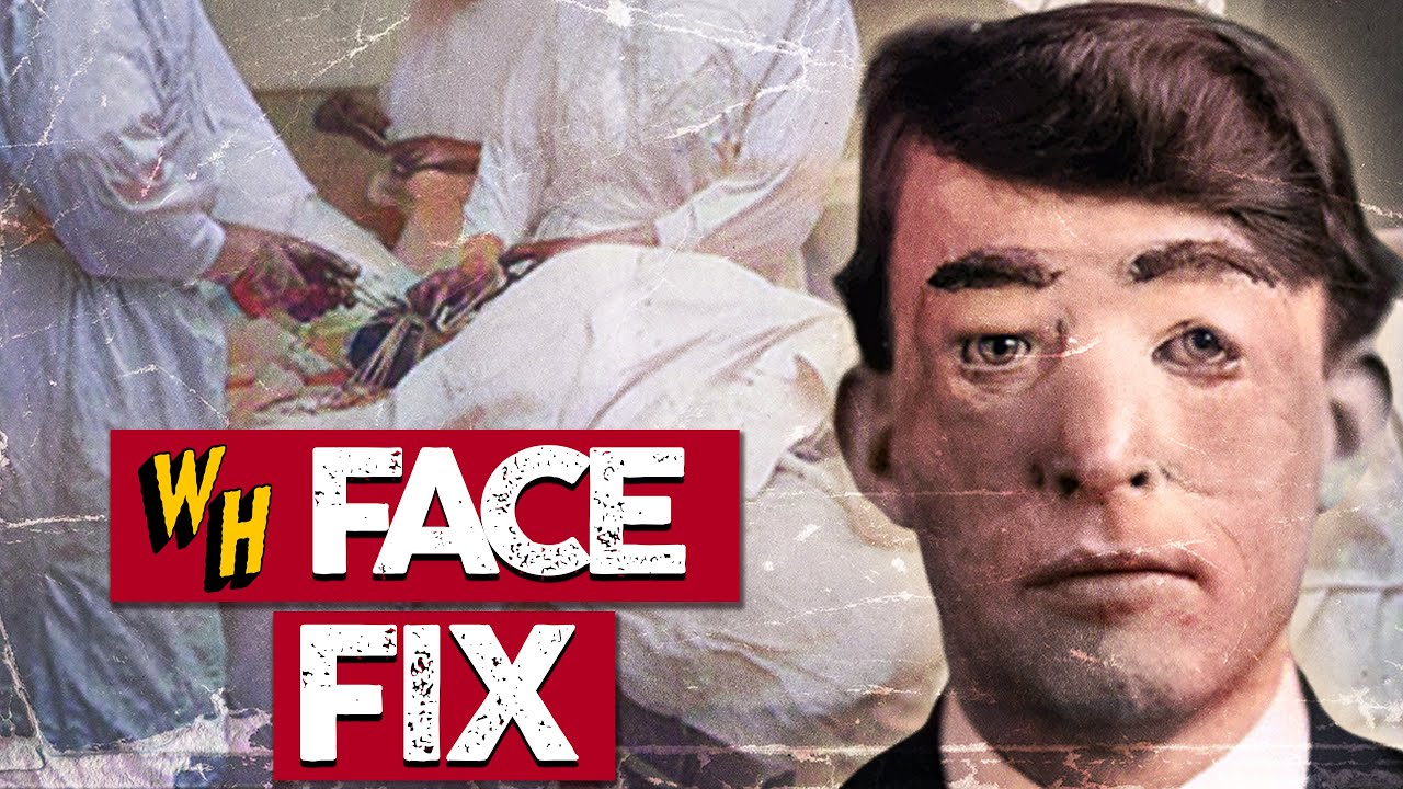 The Crazy True Story Of The First Plastic Surgery In History - YouTube