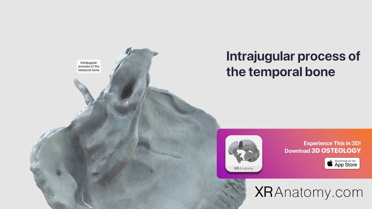 Temporal Bone - Intrajugular process of temporal bone - YouTube