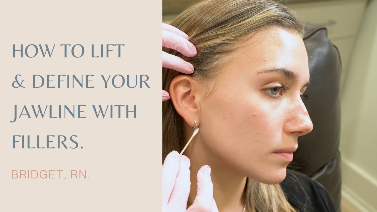 How to Lift and Define your Jawline with Fillers - YouTube