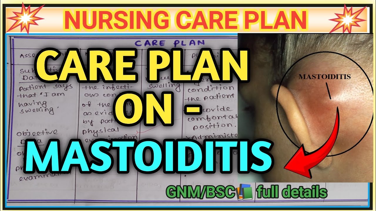 Nursing Care On Mastoiditis | Mastoiditis | Care plan on Mastoiditis in ...