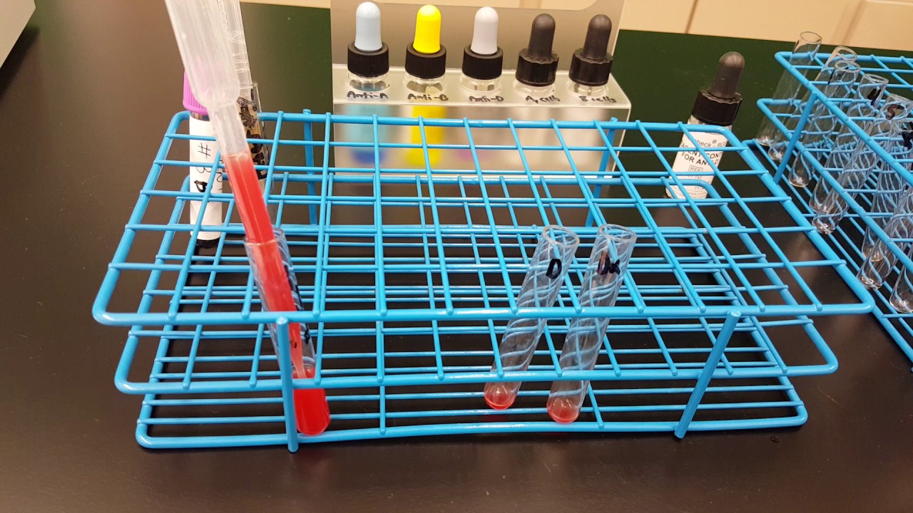 Blood Banking: Weak D test Part 5 - YouTube