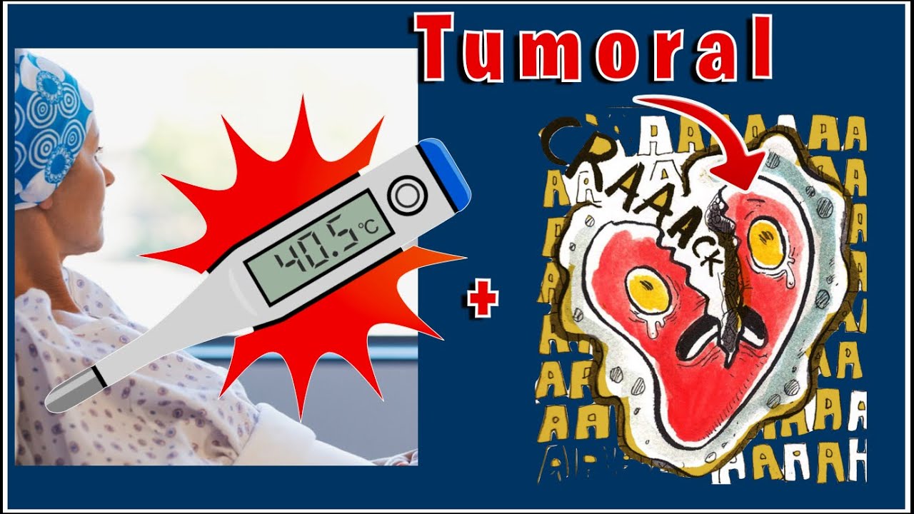 Lisis tumoral y neutropenia febril - YouTube