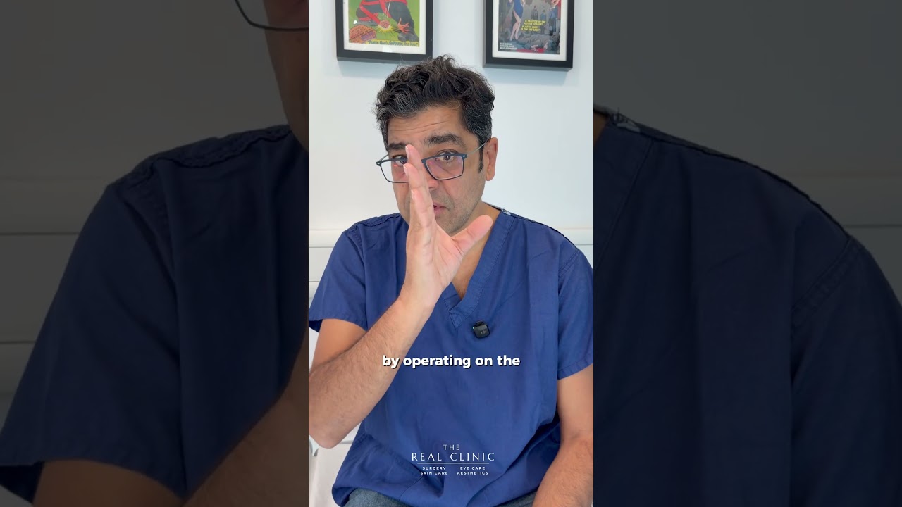 Saddle Nose Surgery | How it Can be Corrected | Real Plastic Surgery