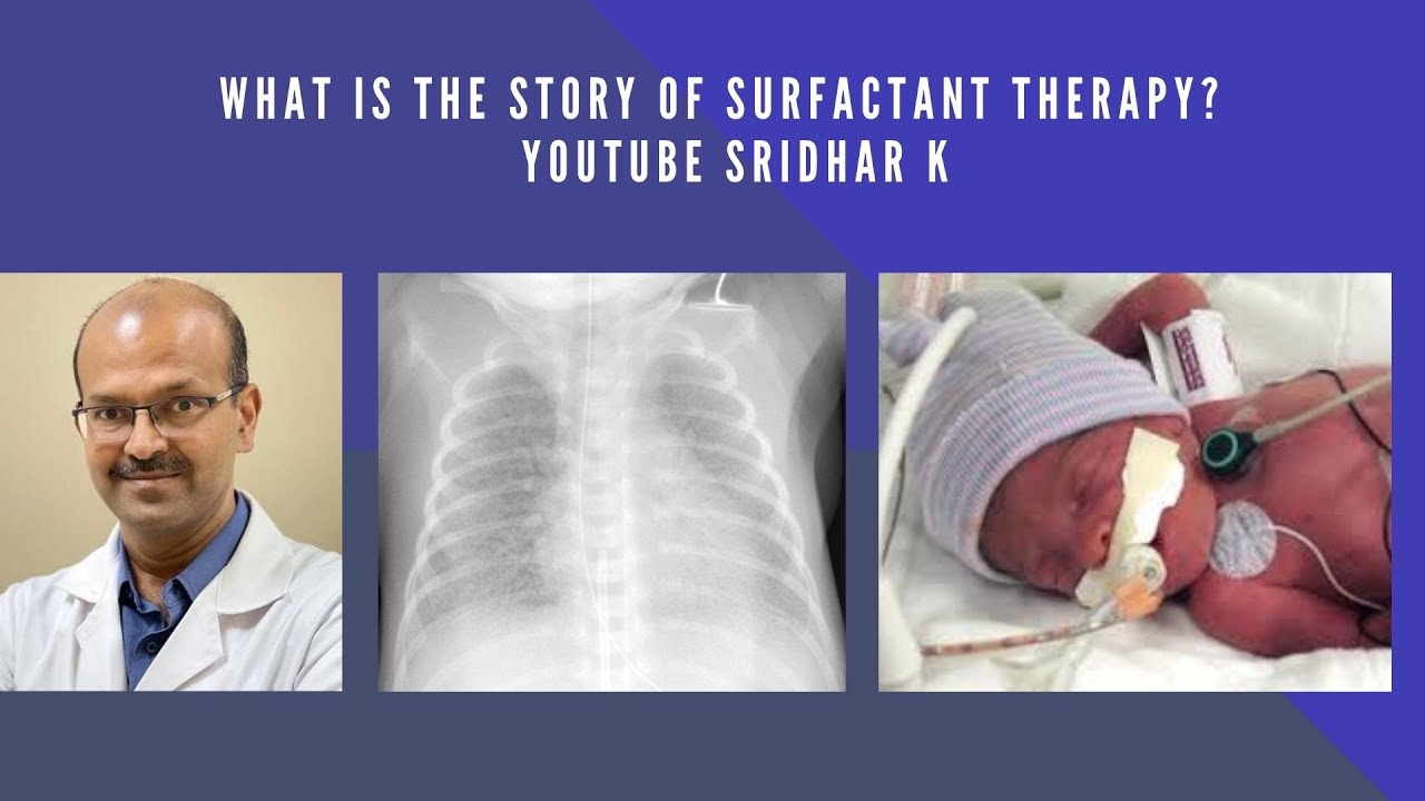 Story of surfactant therapy for treatment of RDS in preterm babies. Dr ...