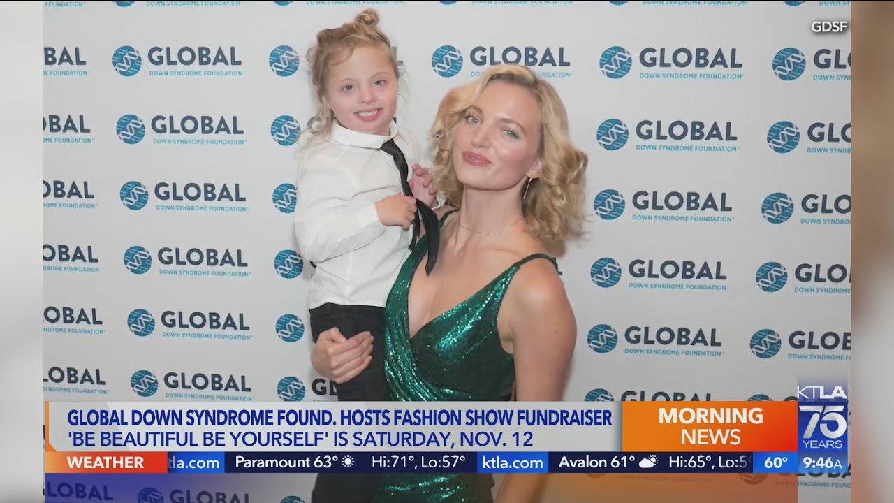 Model and Down Syndrome activist Amanda Booth previews 'Be Beautiful Be ...