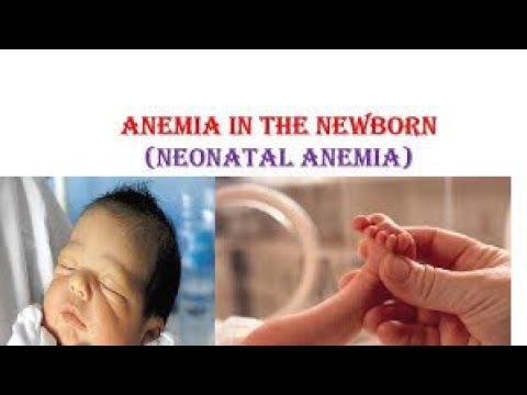 Neonatal anemia (Anemia in the Newborn) - YouTube