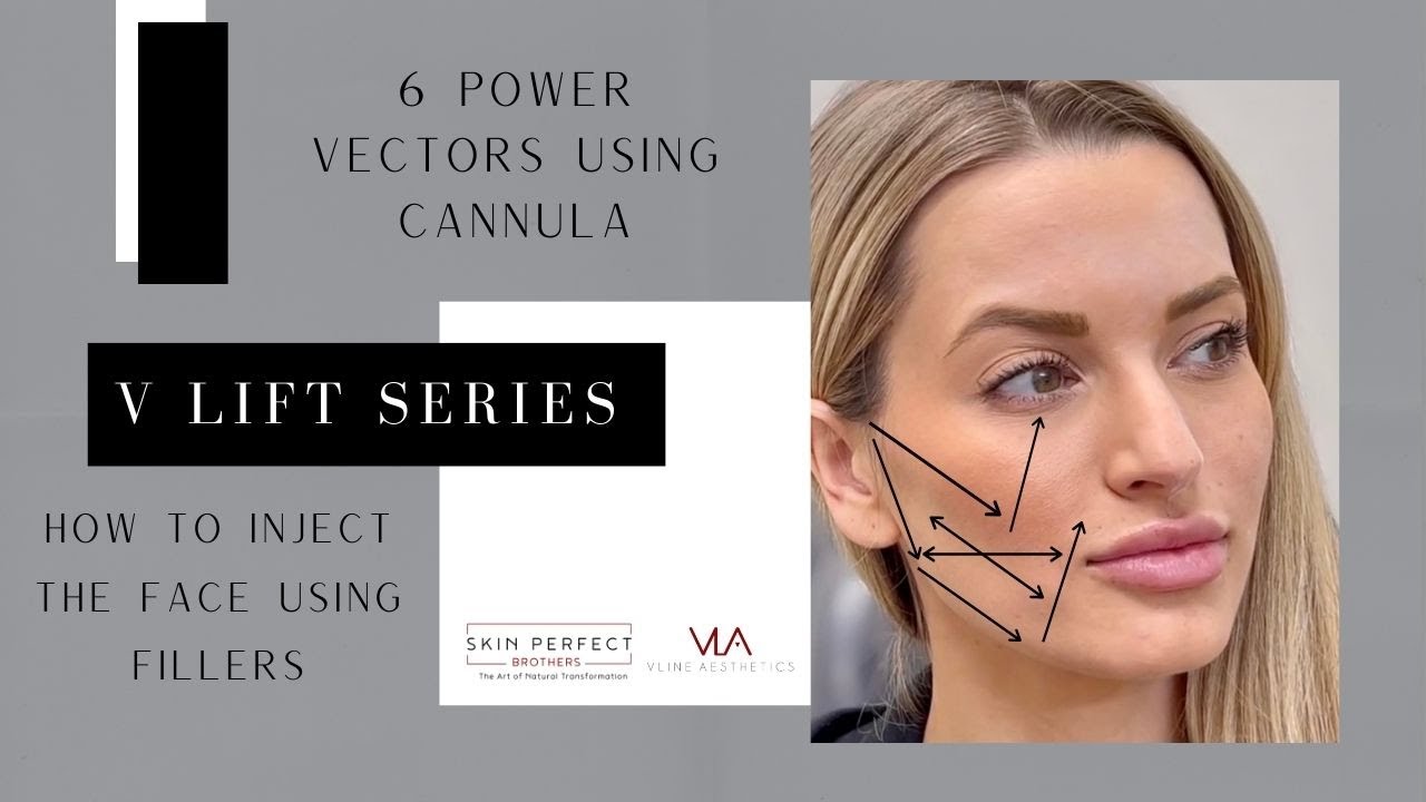 V Lift Series | How to Inject Using Fillers | V Line Aesthetics & Skin ...