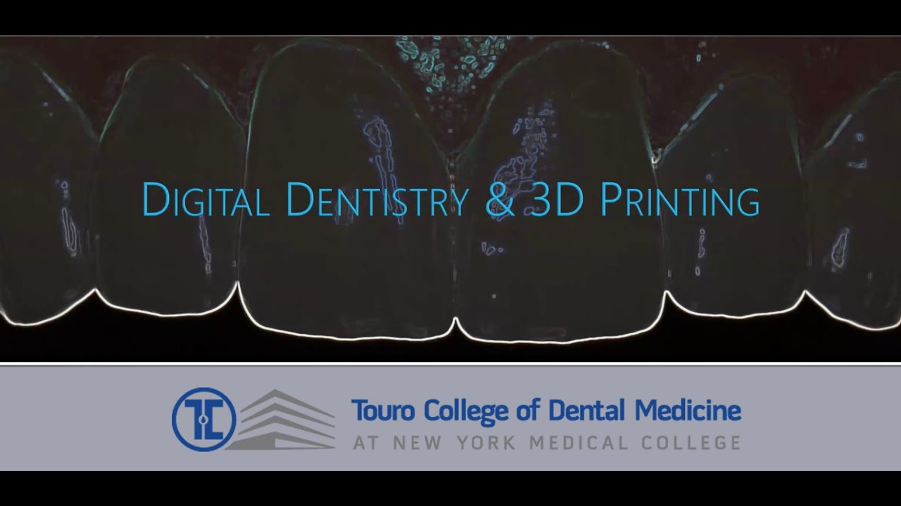 3D Printing in Digital Dentistry - YouTube