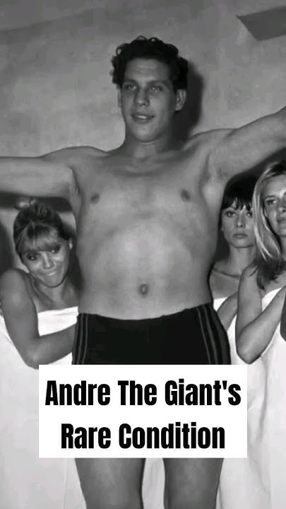 Andre The Giant Famously Suffered From Acromegaly #andrethegiant #wwe # ...