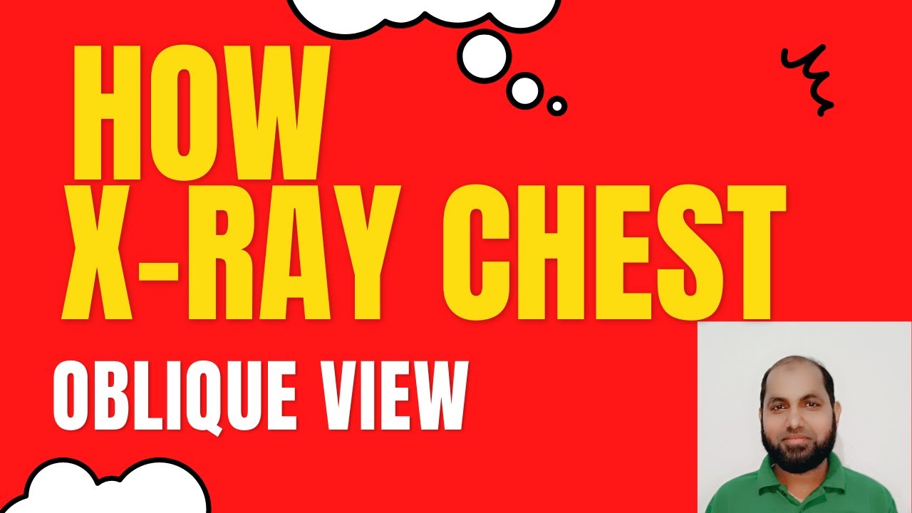 X-ray Chest Oblique view/RAO/LAO/RPO/LPO/In URDU/HINDI - YouTube
